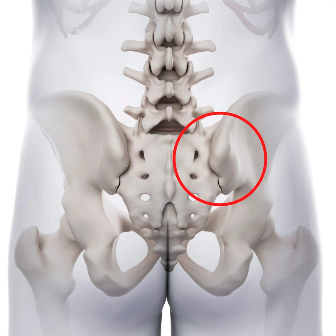 SI-nivel | Alaselkäkipu | Alaselän kivun hoito | Nivelmanipulaatio